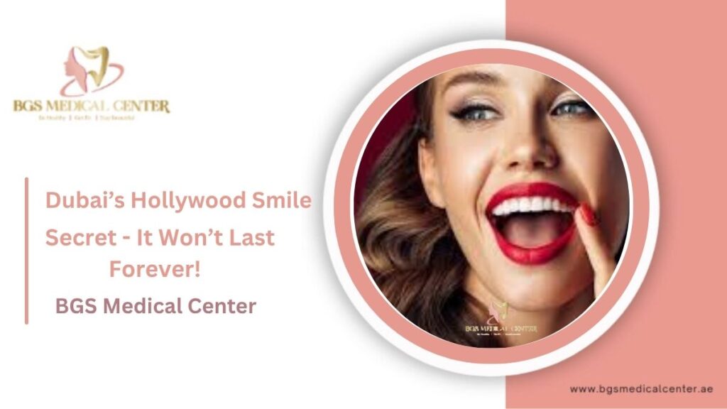 Hollywood Smile Longevity Dubai, Veneer Lifespan & Maintenance Tips